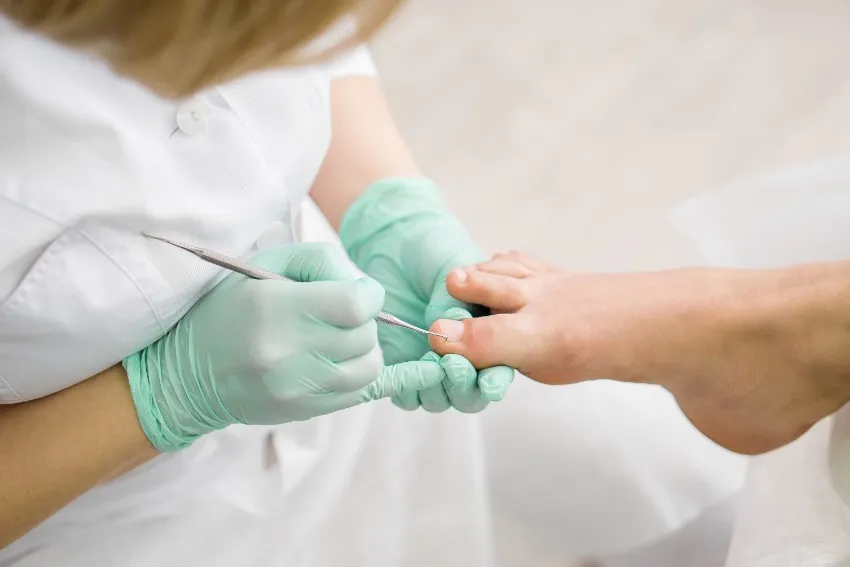 Uña Encarnada Como Prevenirla - Salud Integral De La Mujer